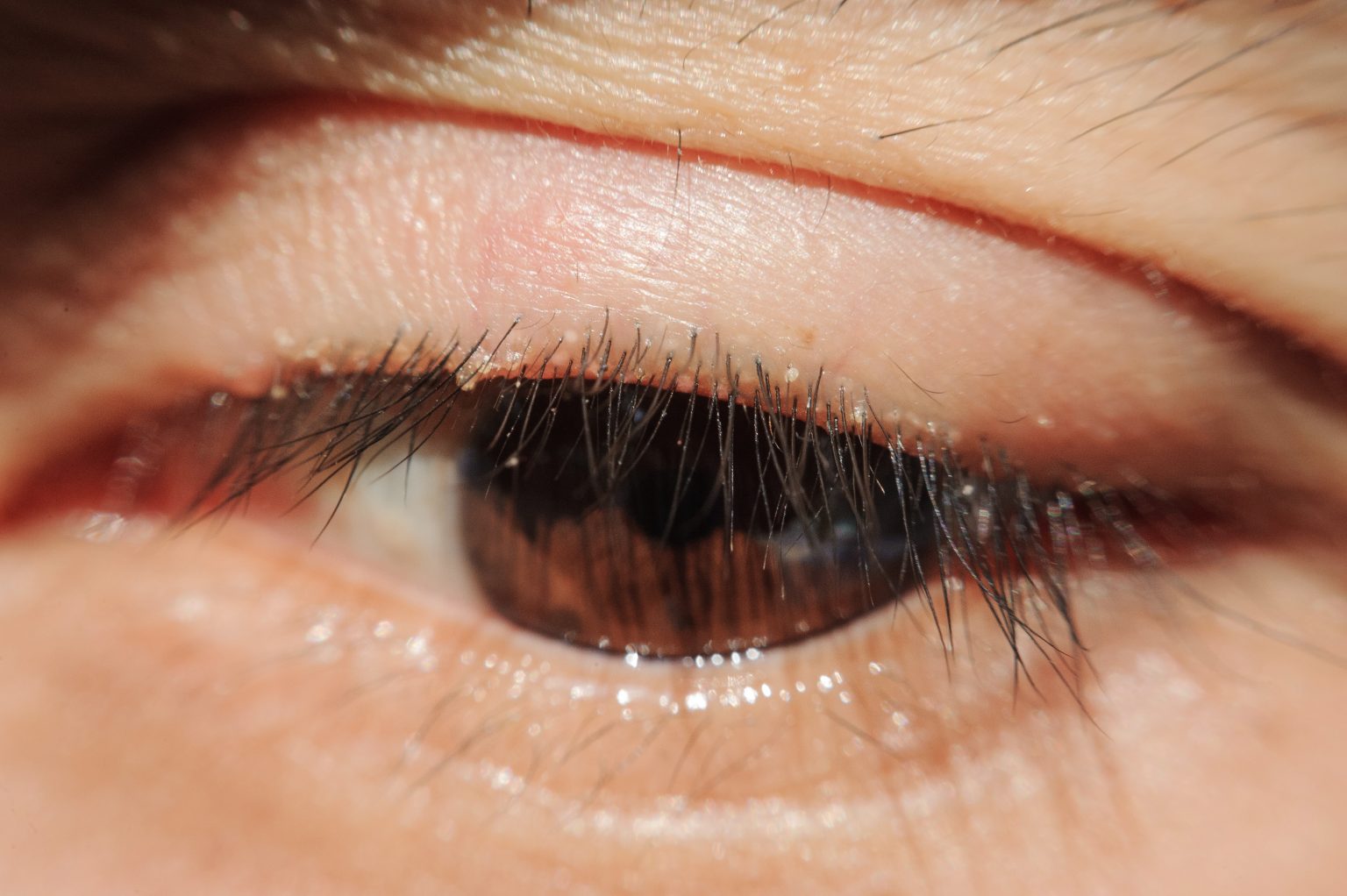 Common Eye Conditions & How to Manage Them | Abra & Co.